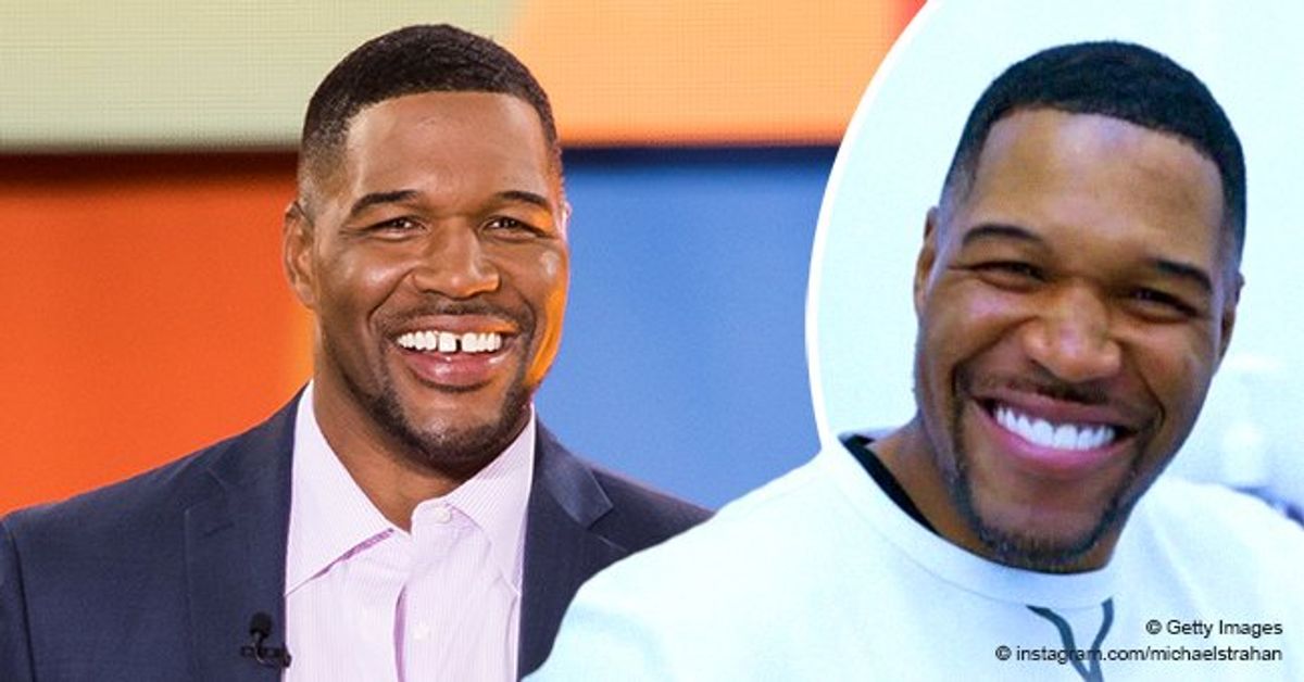 Michael Strahan Says Goodbye to Iconic Tooth Gap — Watch Amazing Video ...