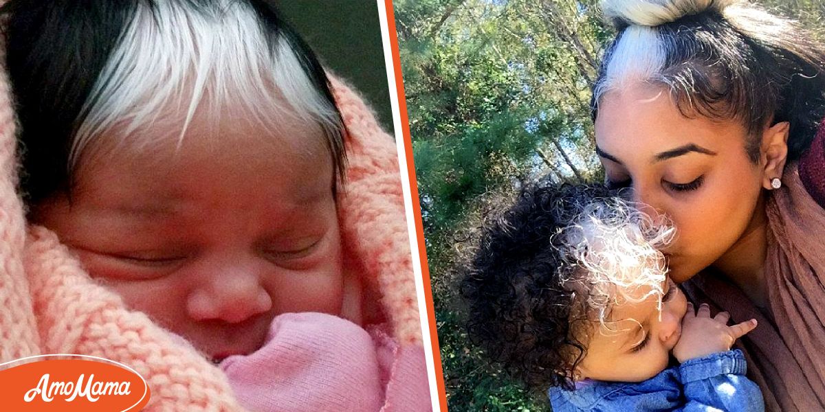 Little Girl Is Born with White Patch in Her Hair — Her Mom and Grandma ...