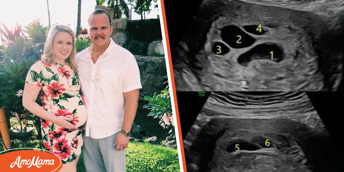 Pregnant Woman Goes for an Ultrasound – Sees 6 Black Circles around Her ...