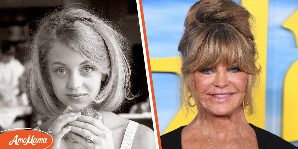 Has Goldie Hawn Had Plastic Surgery? Experts Weigh In