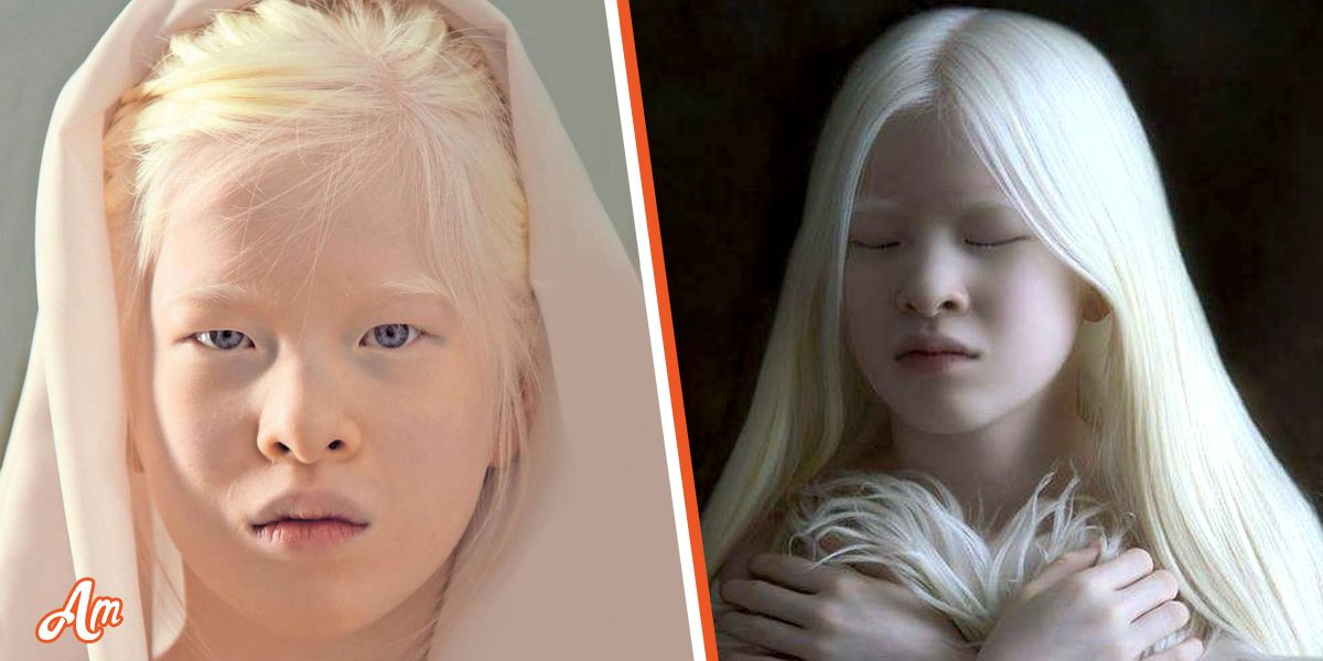 Baby Girl Was Abandoned at Orphanage Doorstep for Her Looks – She ...
