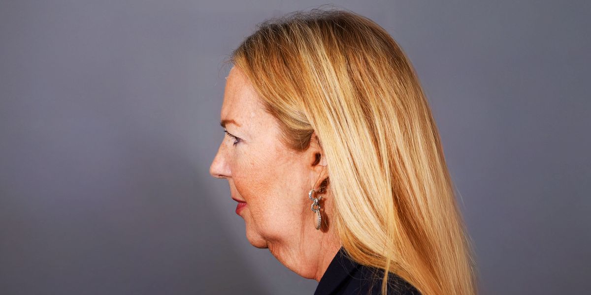 A Woman Underwent Plastic Surgery and Left Everyone Perplexed: 11 ...