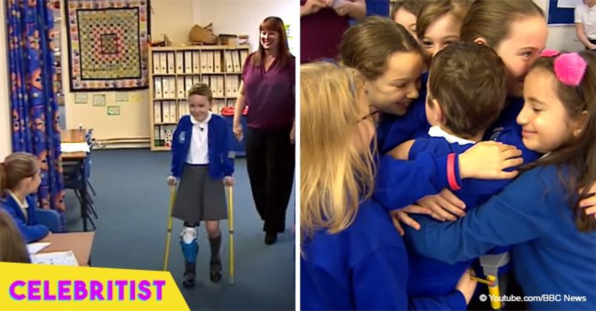 Story of how kids reacted after girl enters class on prosthetic leg for ...