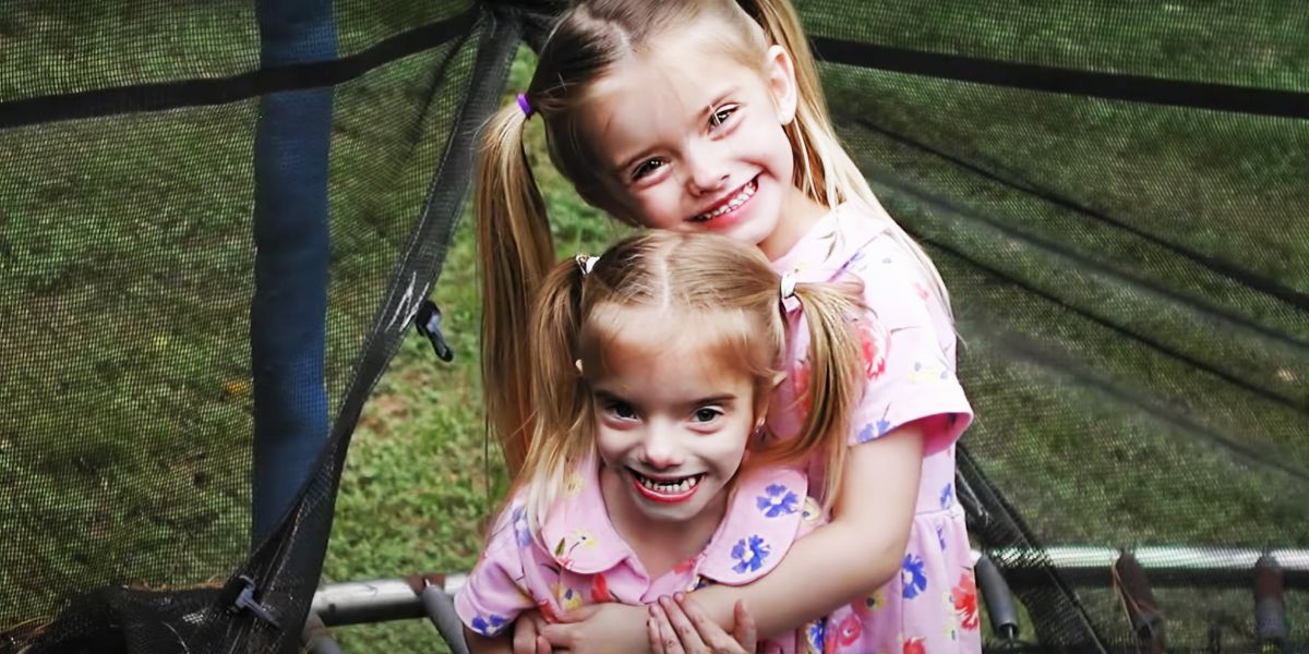 What These Identical Twins, One of Whom Is Over a Foot Taller, Look ...