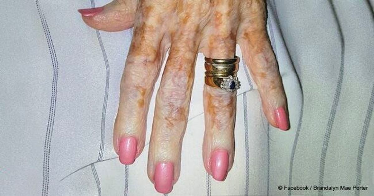 Nurse paints elderly lady's nails and explains the beauty of her hands