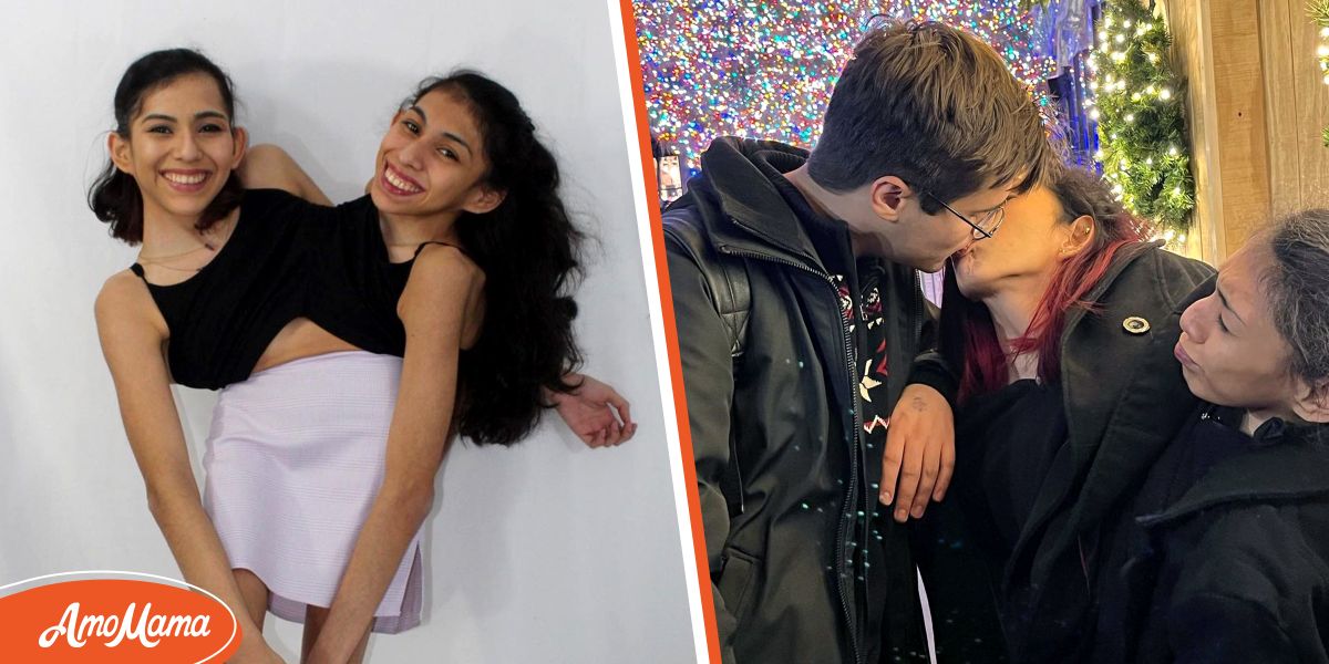 'Shameful': Man Mocked for Dating Conjoined Twin for Years – They Prove ...