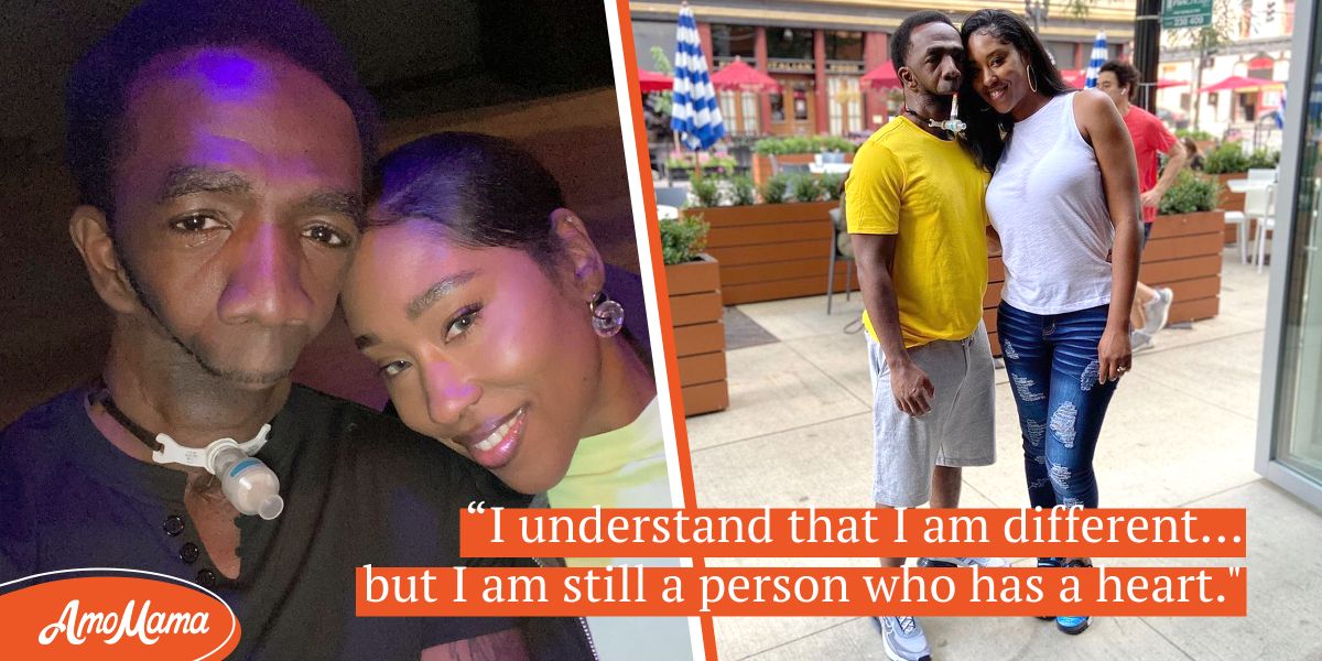 'She Can’t Kiss Him': Man without a Jaw Finds Love after Being Bullied ...