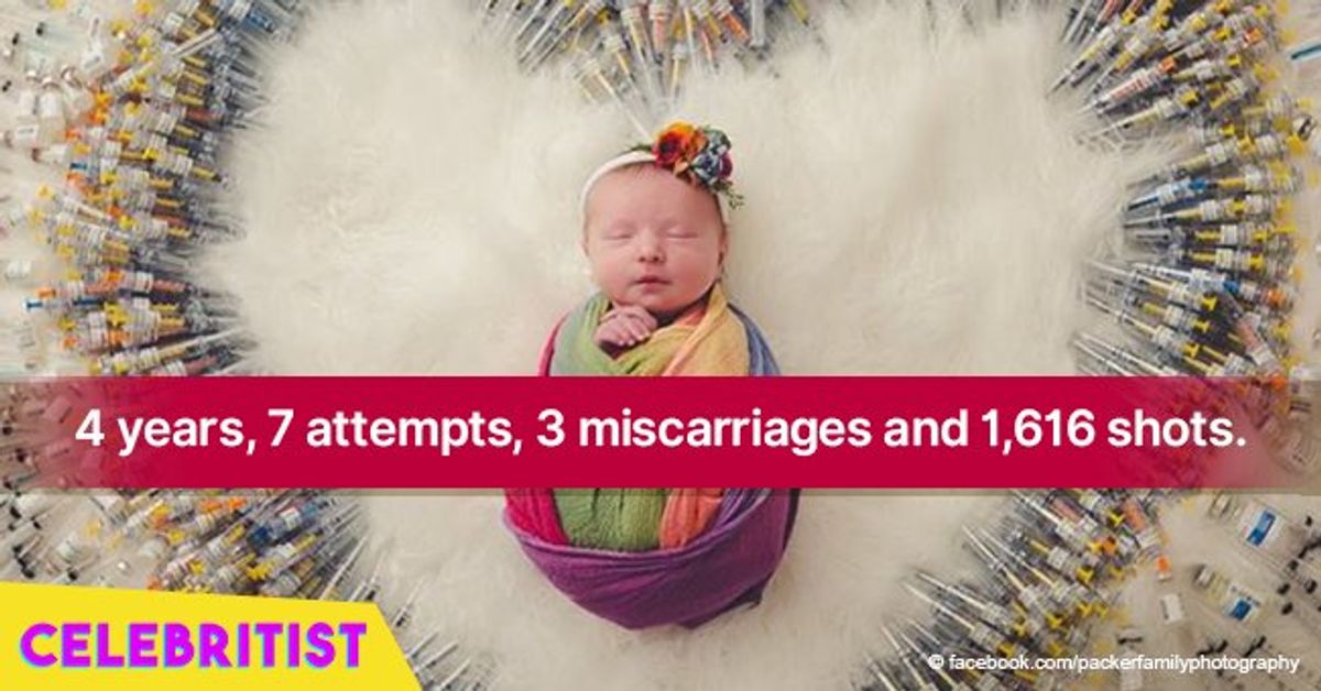 Parents’ photo of baby encircled by hundreds of IVF needles went viral ...