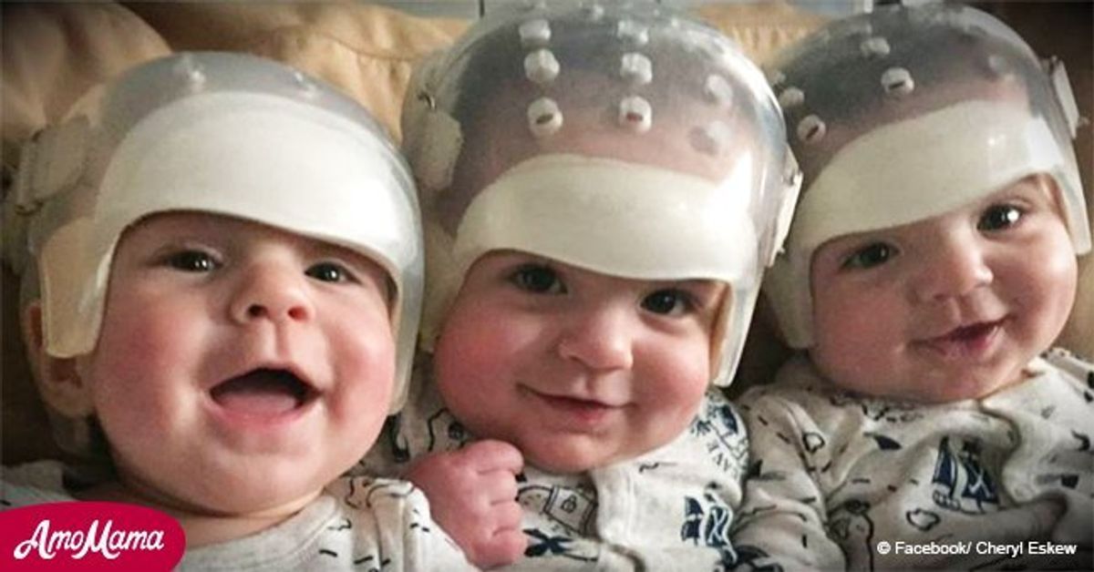 Meet the 'rarest triplets in the world' - these brave little boys have ...