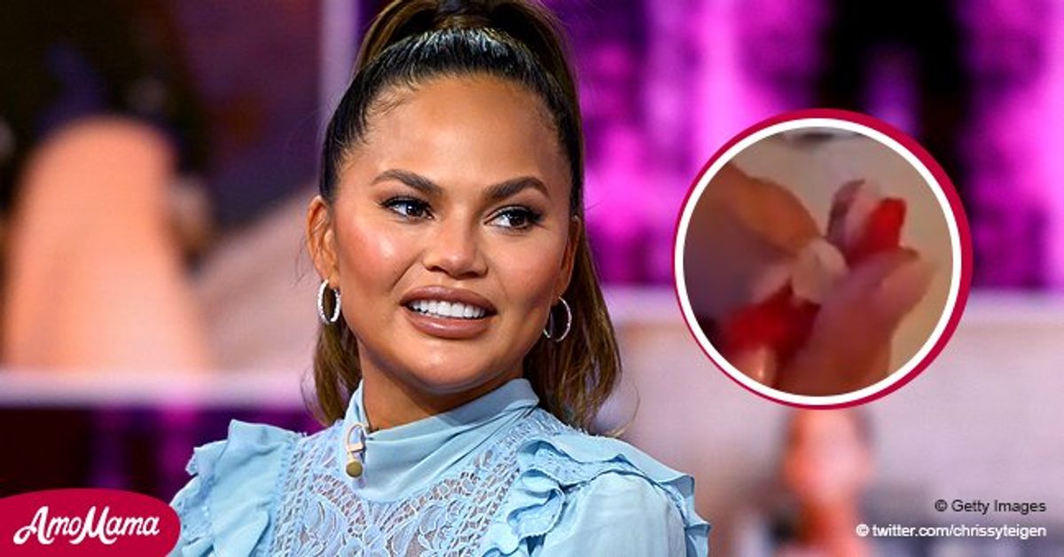 Chrissy Teigen Reveals in a Candid Video She Lost Her Tooth — Here's ...