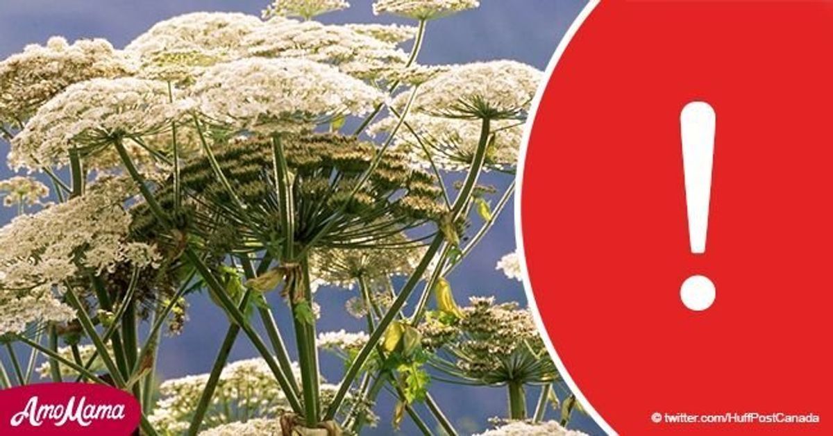 Safety alert: Officials warn of toxic plant that can cause severe burns ...