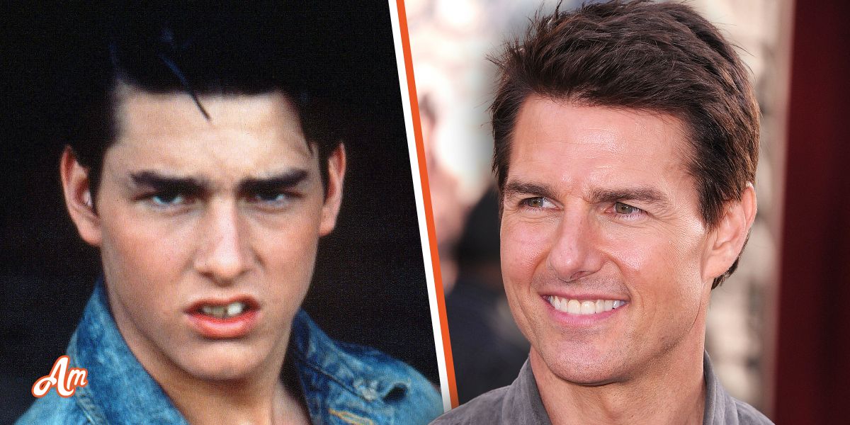 Tom Cruise's 'Crooked' Teeth Transformation Sparks Discussion, Yet ...