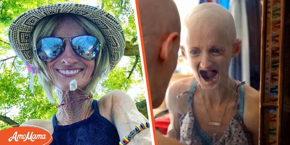 Woman Who Ages 8 Times Faster than Normal Impresses Fans with Her ...