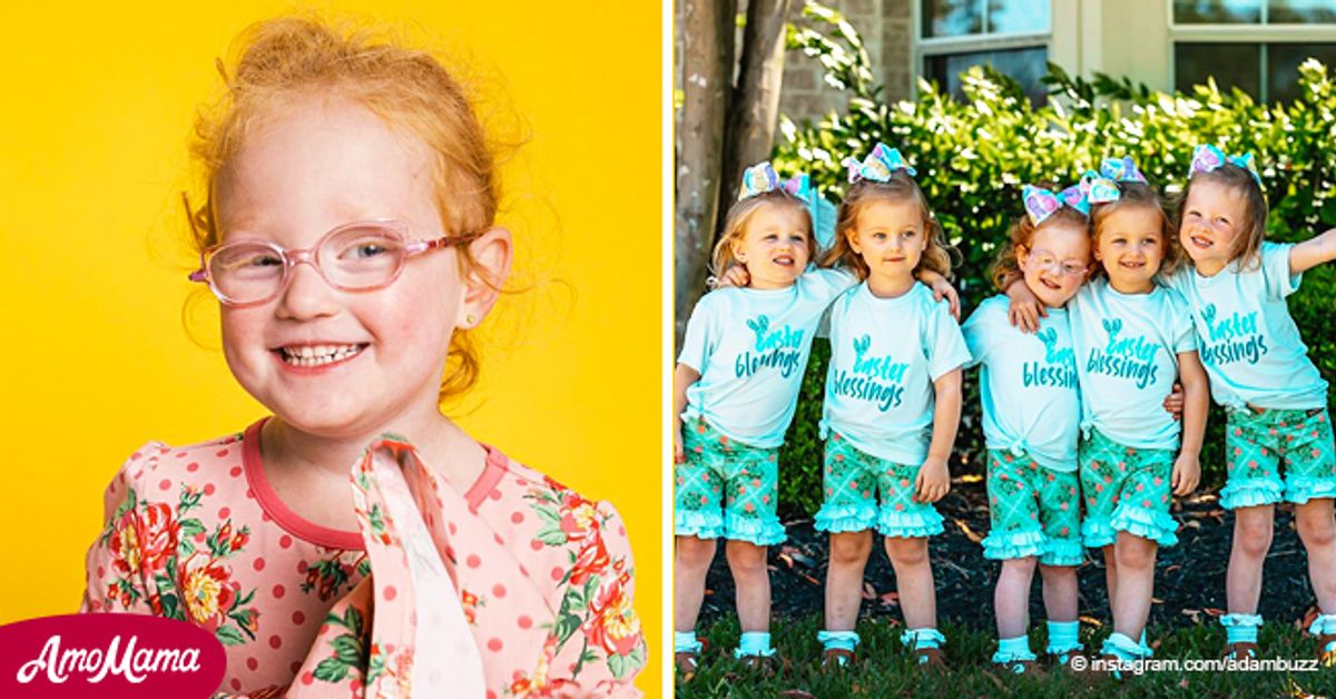Story behind Hazel from 'OutDaughtered' Undergoing Eye Surgery for ...