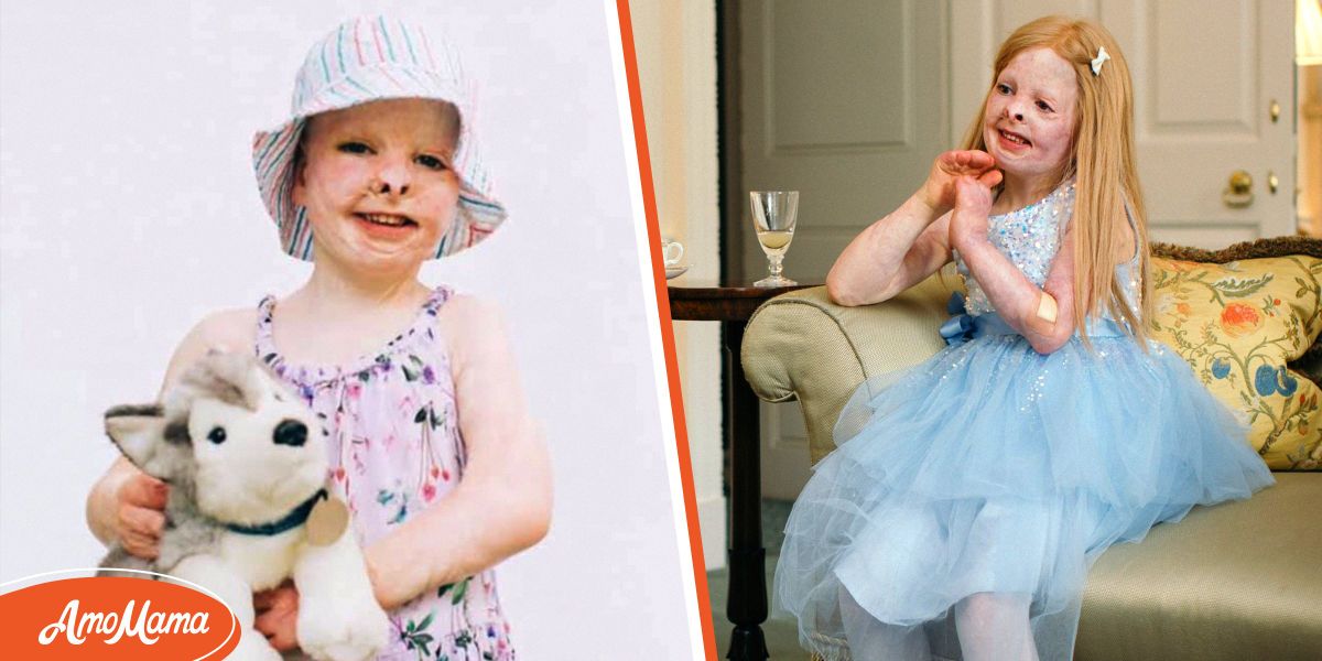 8-Year-Old 'Angel' Who Survived Crib Fire Raises over $200,000 for the ...