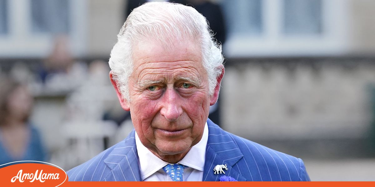 King Charles’ Health Journey: From Facial Growth & Swollen Fingers to ...