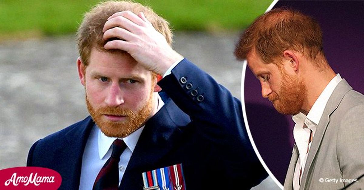 The Sun: Prince Harry Got Thickening Treatment at Prestigious Hair Loss ...