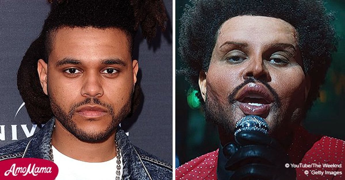 The Weeknd Looks Barely Recognizable with Face Fillers in His 'Save ...