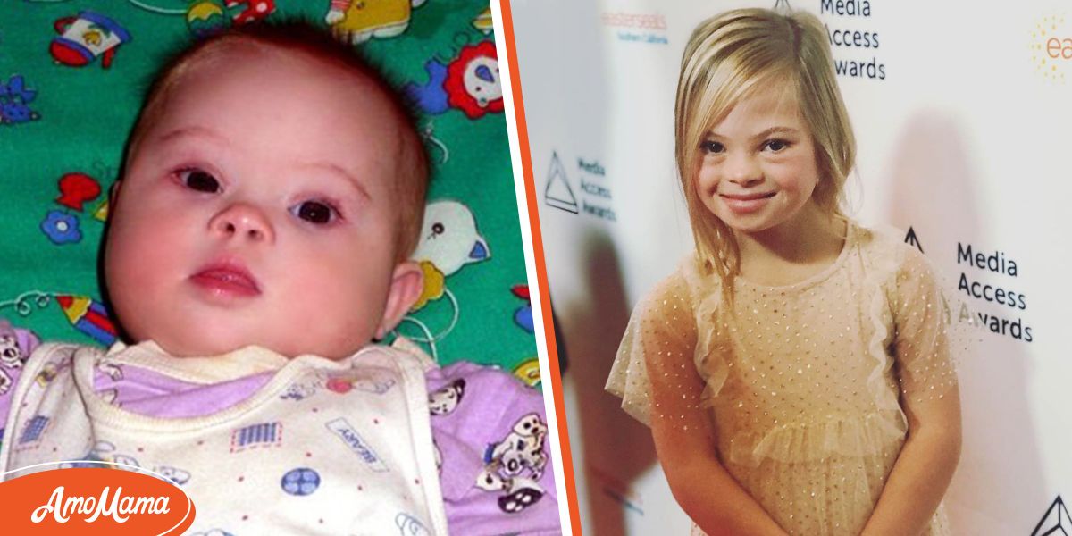 Baby with Down Syndrome Abandoned at Birth Becomes an Actress Years Later