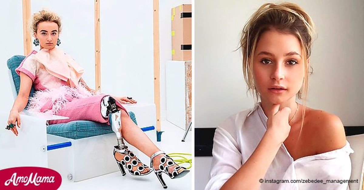 Modeling Agency Redefines Beauty in Fashion Industry by Representing ...