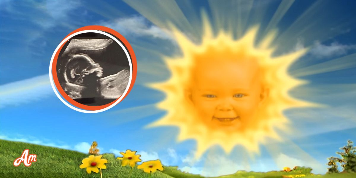 Teletubbies Sun Baby Is Pregnant with 1st Child - Her Identity Was a ...