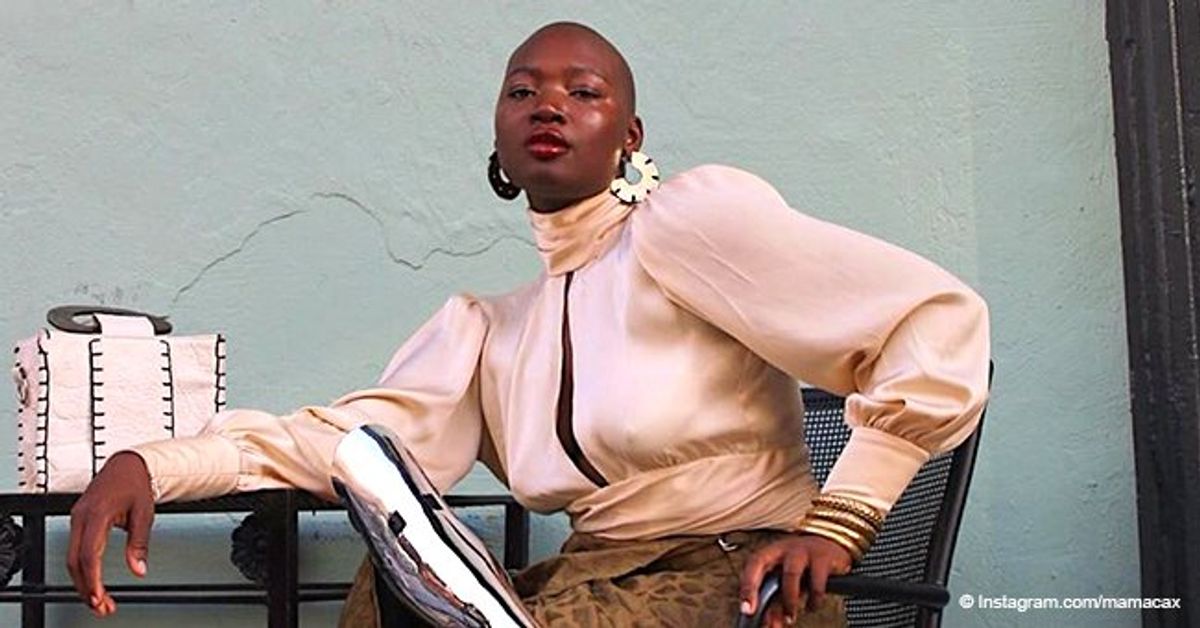 Mama Cax, Amputee Model and Disability Advocate, Passes Away at Only 30