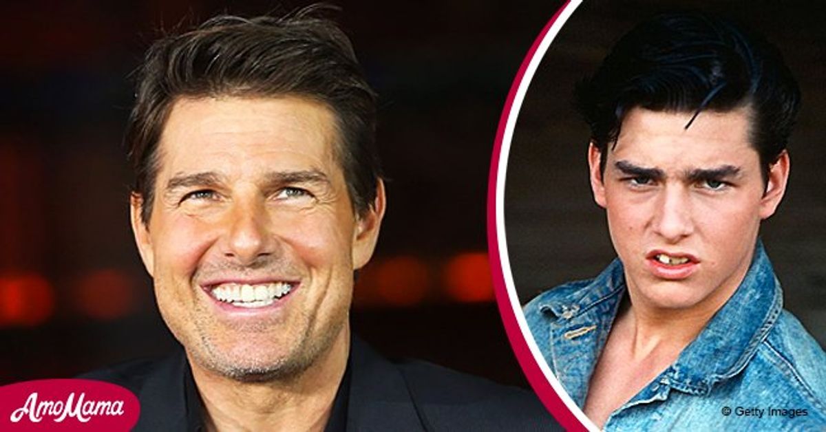Tom Cruise's Teeth Are His Hallmark — Facts about the Actor's Middle ...