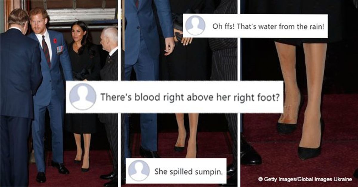 Puzzling 'stains' on Meghan Markle's foot leaves royal fans guessing
