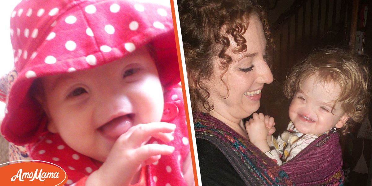 Baby Born without Nose Looks 'Amazing' at 10 after Surgery - Her Mom ...
