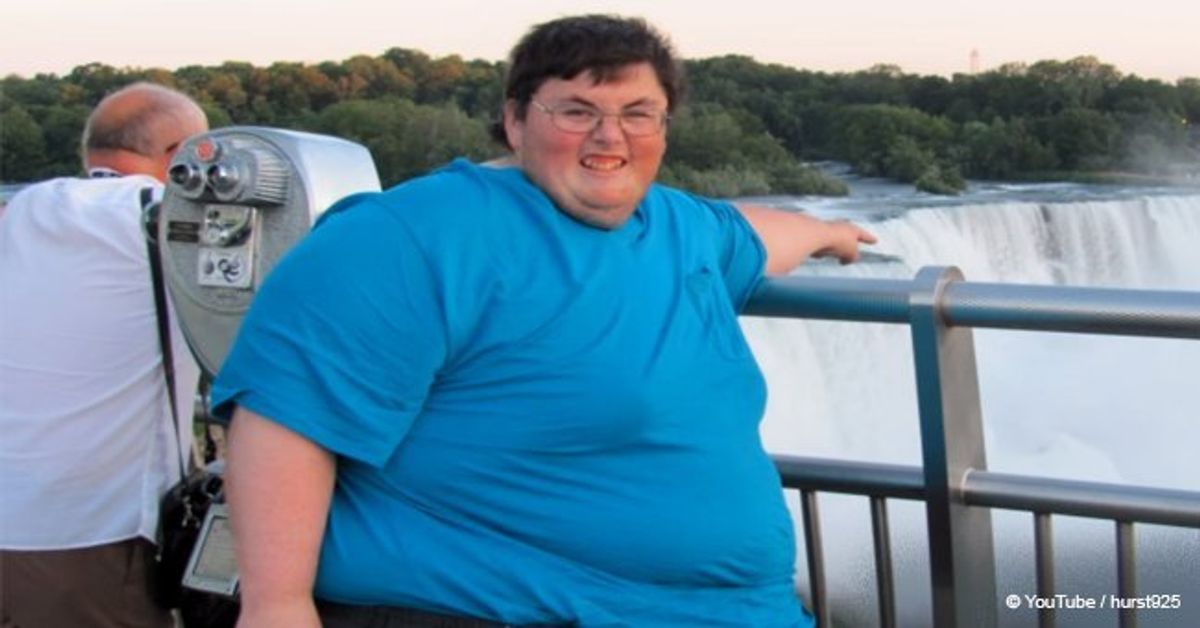 One-legged man loses whopping 500-lb after doctors gave him three ...