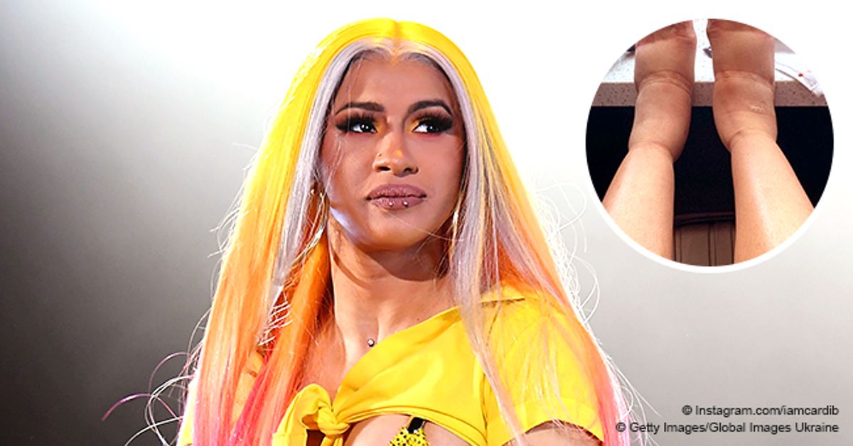 Cardi B Shares Pic of Extremely Swollen Feet after Plastic Surgery ...