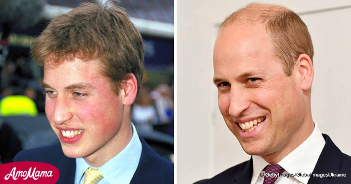Prince William Reveals He Got a 'Harry Potter' Scar after Being Hit ...