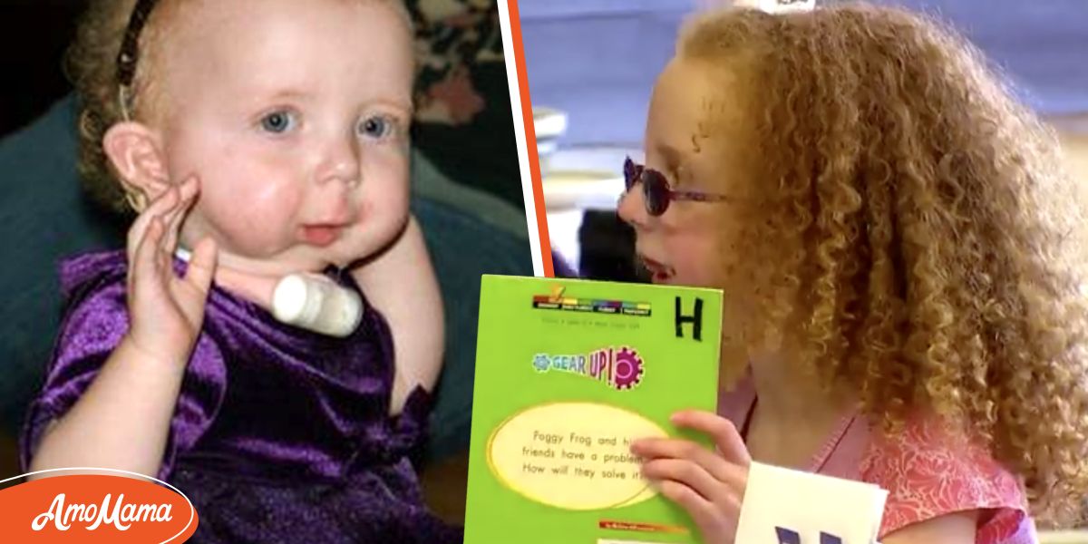 Girl Born Without A Jaw Grows One With Doctors Help — At 7 She