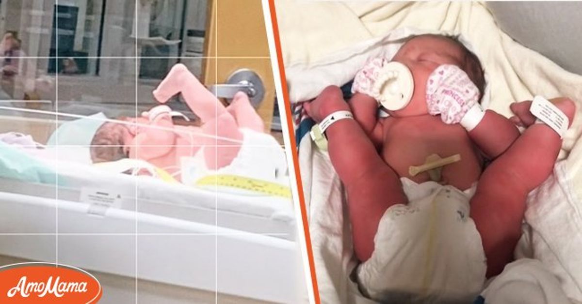 Mother Posts Video of Her Baby Born with Legs around Her Head and ...