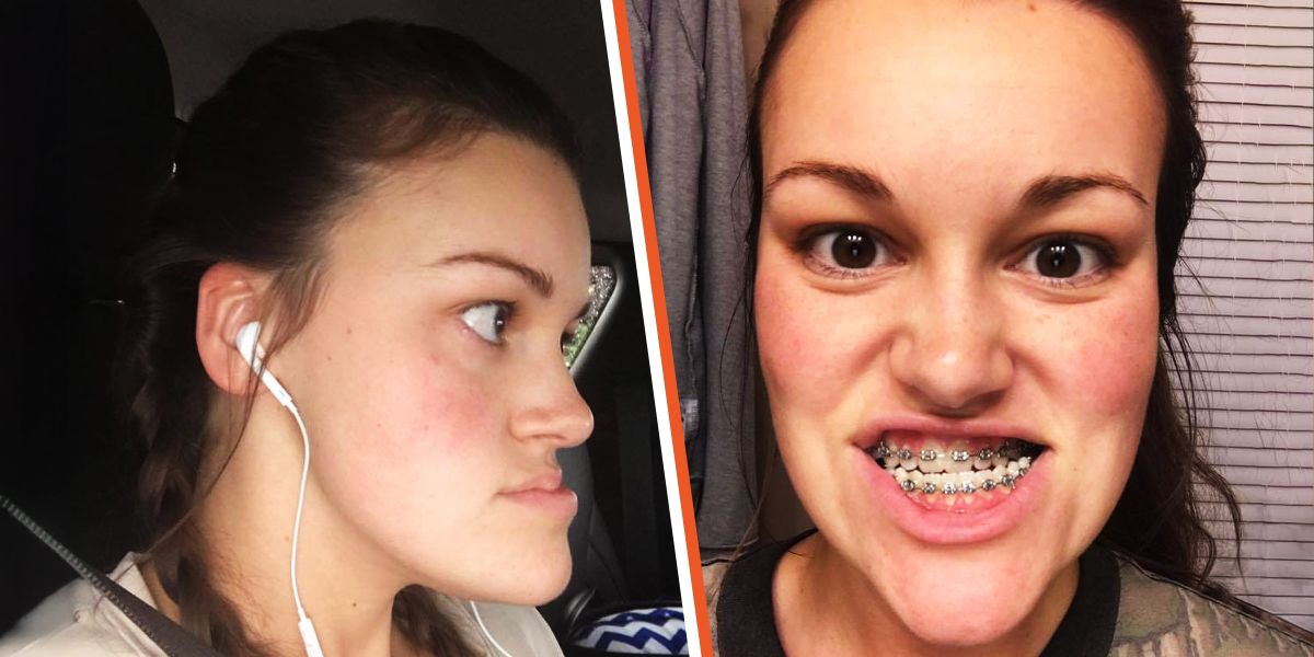 This Young Woman, Who 'Hated Looking in the Mirror,' Underwent Double ...