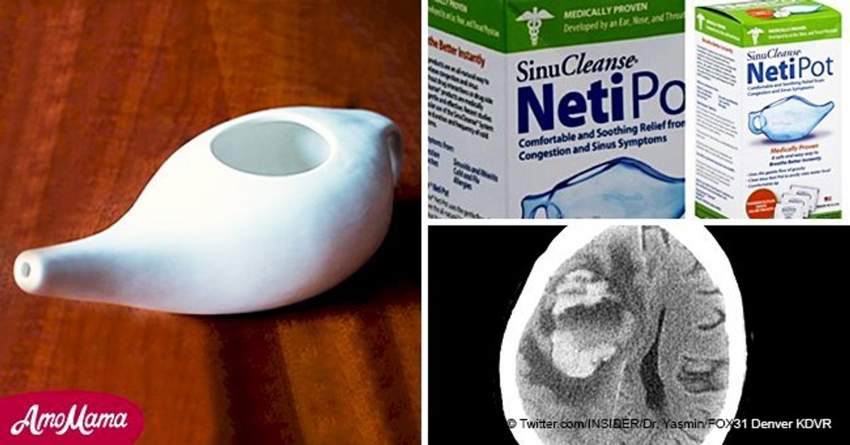 69-year-old woman dies from brain-eating amoeba after using neti pot ...