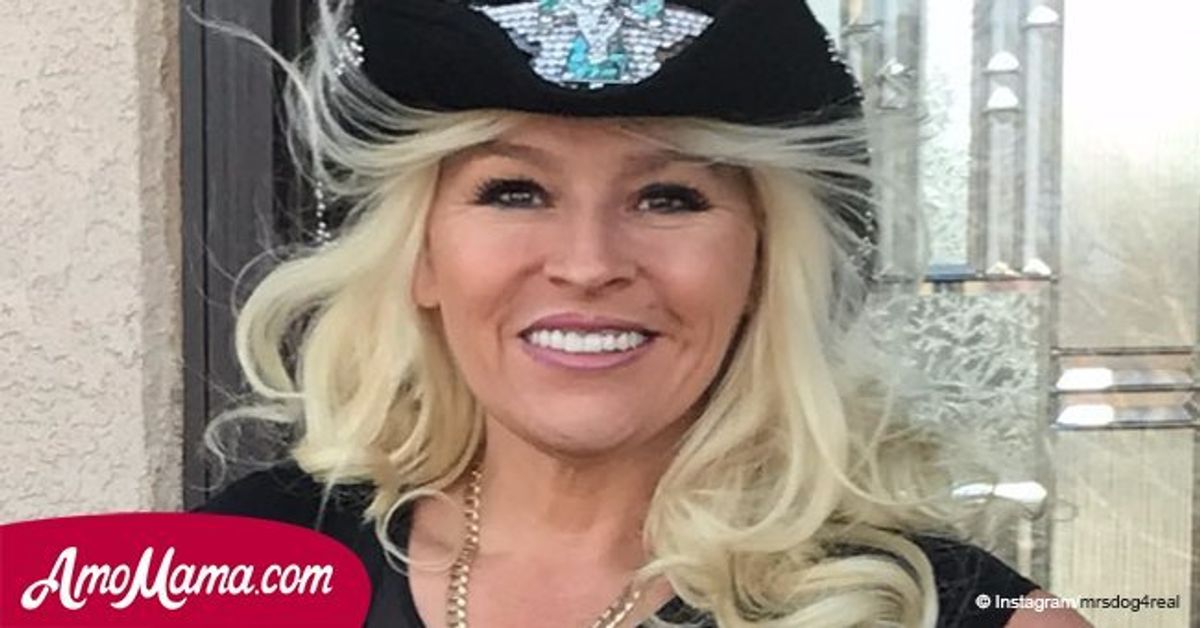 Beth Chapman's new 'after tumor-removal' picture faces a string of ...