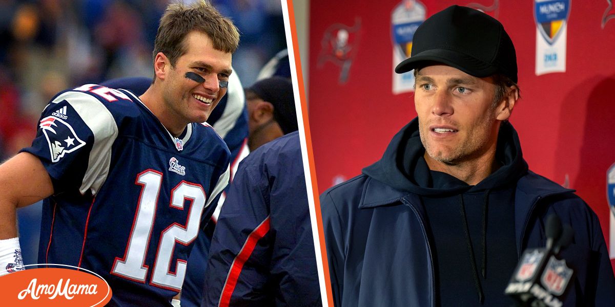 Did Tom Brady Get Plastic Surgery? An Expert Weighs in on the NFL Star ...