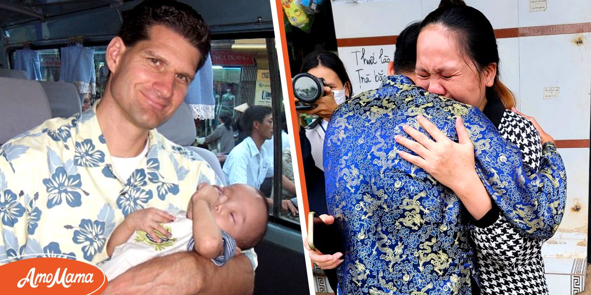 Parents Give Up Their Baby after Seeing His Disfigured Face — He Finds ...