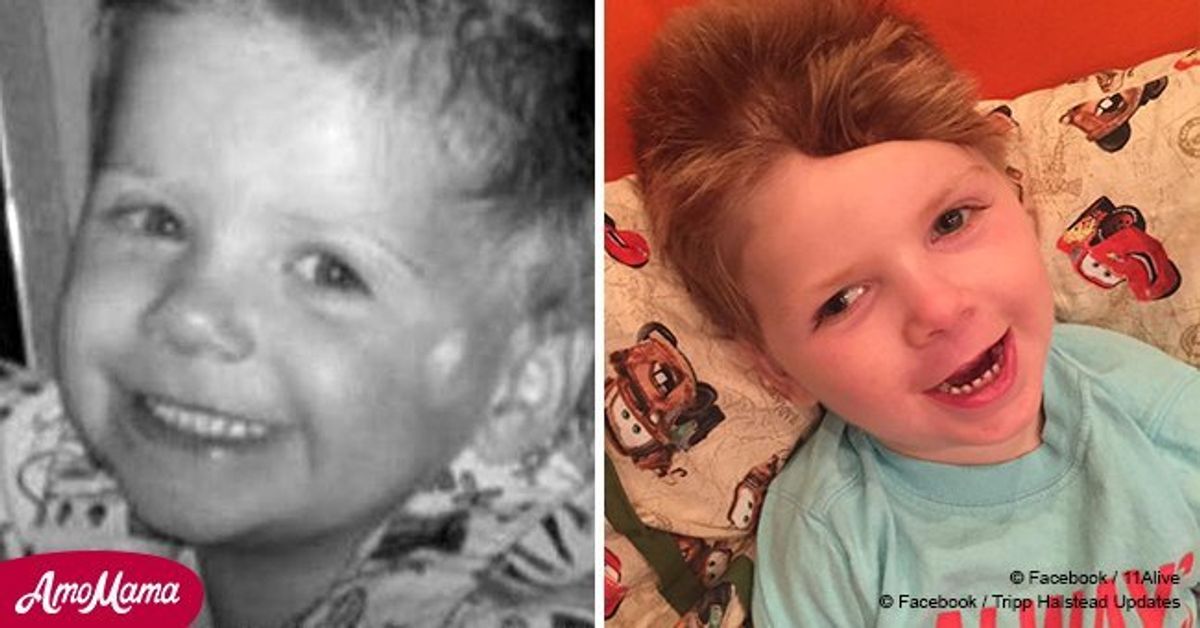 The boy who was struck by a falling tree branch outside his day care ...